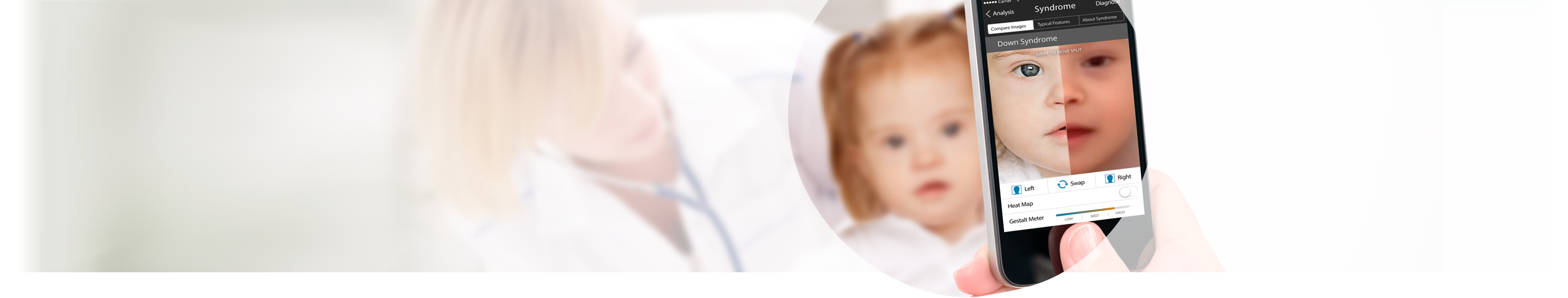 Face2Gene Clinic - Enhanced Patient Evaluation with Deep Phenotyping